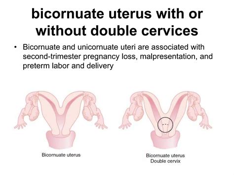 Congenital Anomalies Of Female Reproductive System Ppt