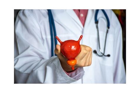 L Embolisation Prostatique Une Percée Innovante dans le Traitement