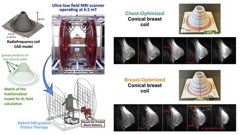Breast Coil Optimization For Low Field Mri And Future Mr Guided Proton Therapy Ieee
