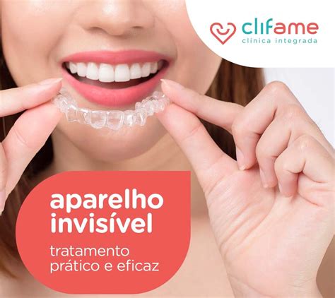 Guia do Aparelho Invisível Clifame