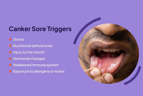 Canker Sore Vs Cold Sore Inside Lip