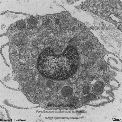 Pseudopods Dr Jastrows Electron Microscopic Atlas