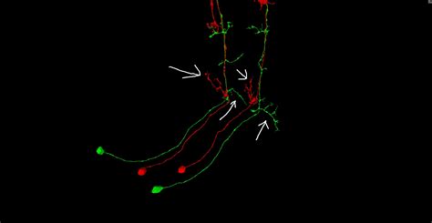 Useful Structural Patterns In The Optic Lobe Inferring Microstructure From Macrostructure