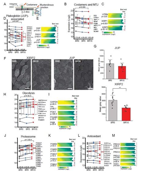 Time Dependent Proteomics Features Of Muscle Fiber Disuse And
