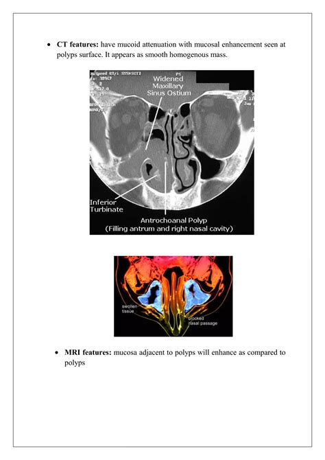 Differiential Diagnosis Of Maxillary Sinus Pathology Docx