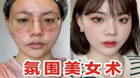 不整容改善面部缺陷贫民窟的逆袭术 YouTube