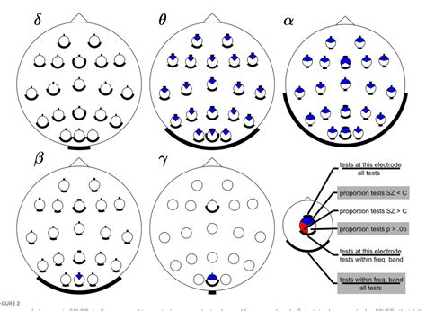 Figure From Steady State Visual Evoked Potentials In Schizophrenia A