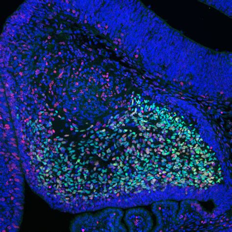 Nih Funded Scientists Generate Mouse Embryo Model That Develops Neural