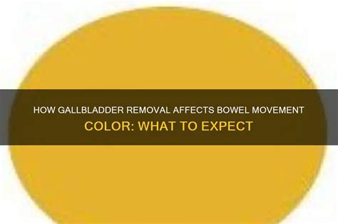 How Gallbladder Removal Affects Bowel Movement Color What To Expect