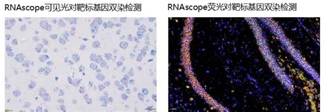 【病理专题】rnascope技术介绍及应用 知乎