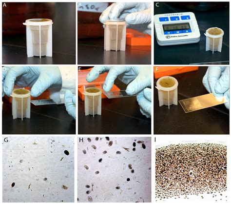 Fecal Float A Feces And Floatation Solution Mixture In