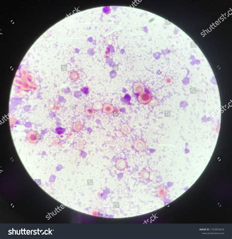 Yeast Cells Under Microscope 400x Micropedia Budding Yeast Cell Under