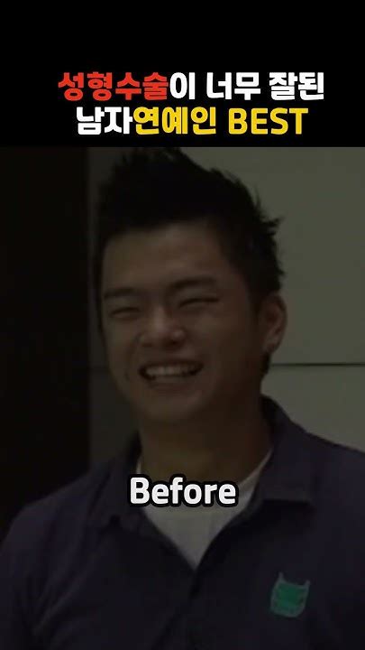 성형수술이 너무 잘 된 남자연예인 Best 12 Youtube