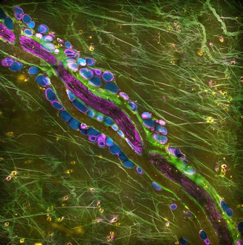 Climb Raises The Clinical Impact Of Label Free Imaging
