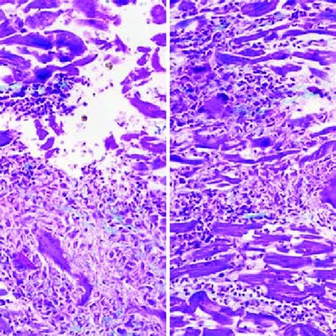 Microscopic Image Of The Myocardium Stained With Massons Trichrome