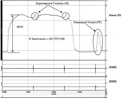 Nterpolated Twitch Technique An Interpolated Doublet Ratio Was Used To