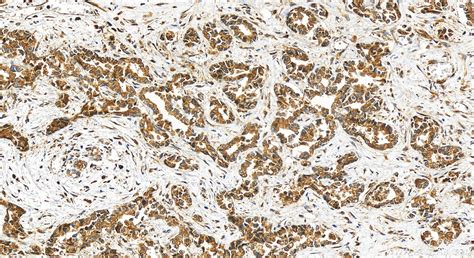 Cmip Antibody 31407 1 Ap Proteintech