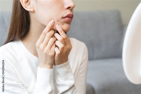 Photo & Art Print Expression worry asian young woman hand touching pustule around the chin and ...