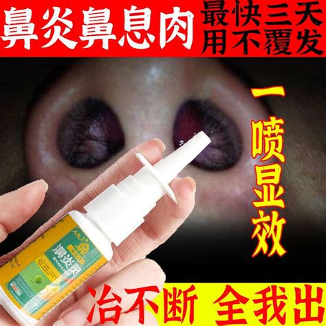 Rhinitis Special Effects Nasal Polyps Nemesis Allergic Rhinitis Spray