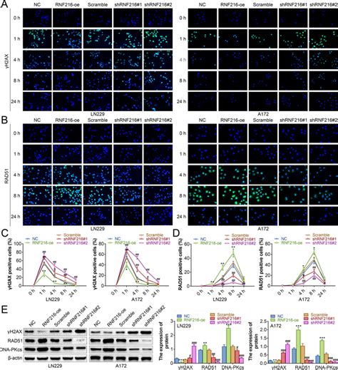 Effect Of Rnf216 On Dna Repair Ability Of Gbm Cells Ln229 And A172