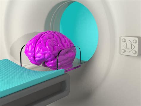 Brain Scan Conceptual Artwork Photograph By Laguna Design Fine Art