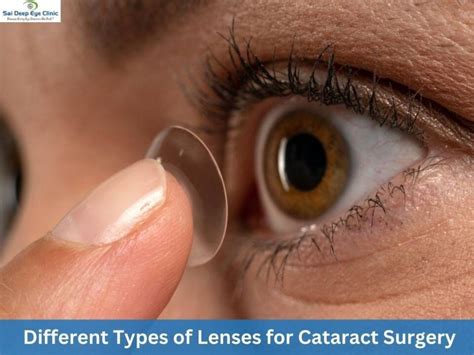 How Different Types Of Lenses For Cataract Surgery Impact Vision Qrius