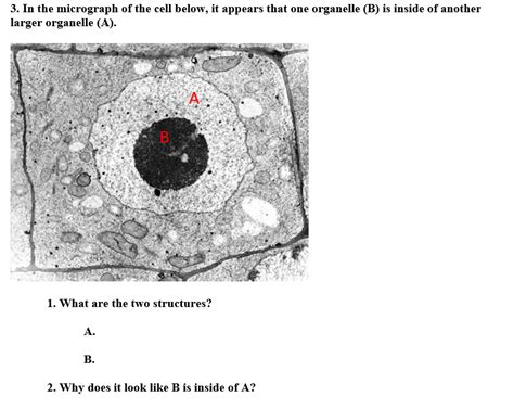 Solved 2 Identify The Structures In An Electron Micrograph
