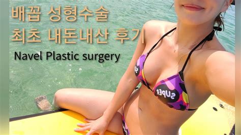 배꼽성형 수술전 수술직후 영상 후기 Youtube