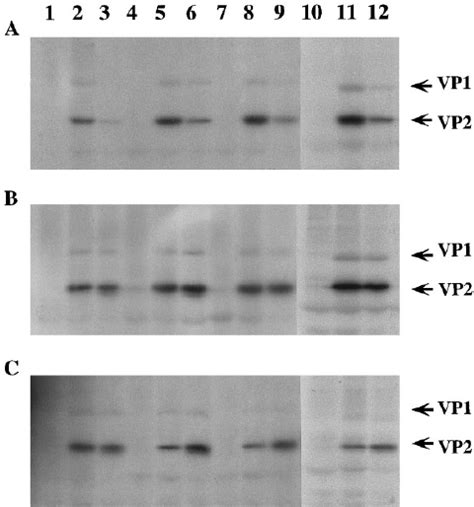 Immunoprecipitation Of Pulsechase Labeled Viral Structural