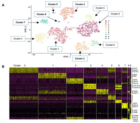 Single Cell Clusters Matching To The Breast Cancer Subtypes A Heat Download Scientific