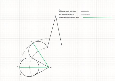 A Bilobed Flap Designed Around A 1r Scd Rblf The Distances From