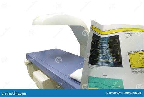 Hip And Spine Bone Mineral Density Bmd Dexa Densitometry Hip Scan Osteopenia Present Frequent