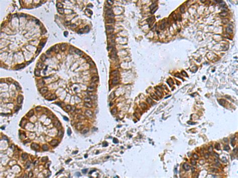 兔抗apcdd1多克隆抗体anti Apcdd1 Rabbit Polyclonal Antibody 生命科学产品与技术服务 生工生物工程