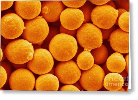 Kluyveromyces Lactis Yeast Cell Photograph By Scimat