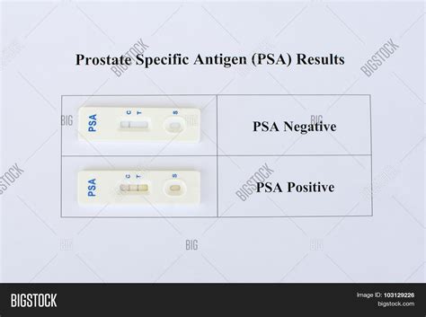 Psa Result Negative Image And Photo Free Trial Bigstock