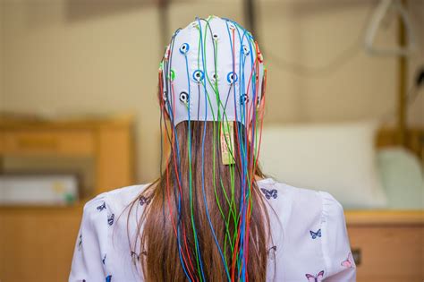 Ghid de pregătire Electroencefalogramă EEG Neuroaxis