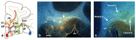 Schematic And Photomicrographs Illustrating The Complexity Of The