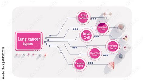 3d Cancer Cell Infographic Lung Cancer Cells Types In 3d Style Tumor