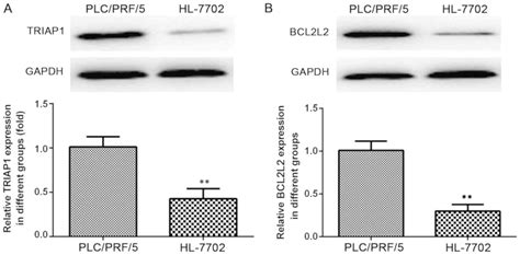 MiRNA125a5p Inhibits Hepatocellular Carcinoma Cell Proliferation And