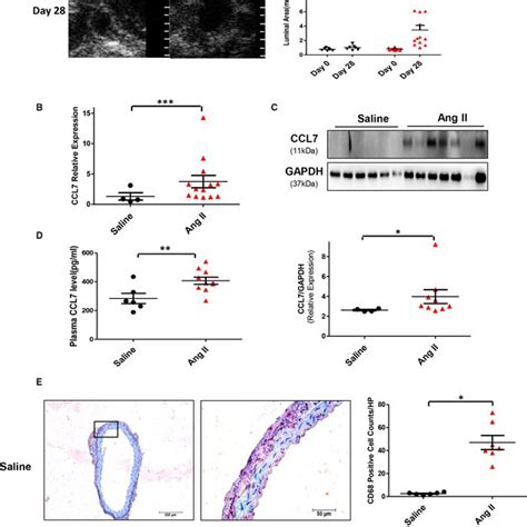 Ccl7 Expression And Macrophages Infiltration Increased In Ang Download Scientific Diagram