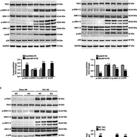 Ubiquitin‐specific Protease 19 Deficiency Exacerbates Heart Hypertrophy