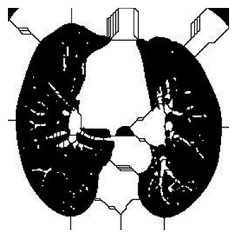 A Input Lung Ct Image B Otsu Output Image C Watershed Output