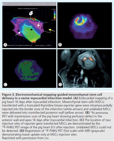 Tracking Stem Cells For Cardiovascular Applications In Vivo Focu