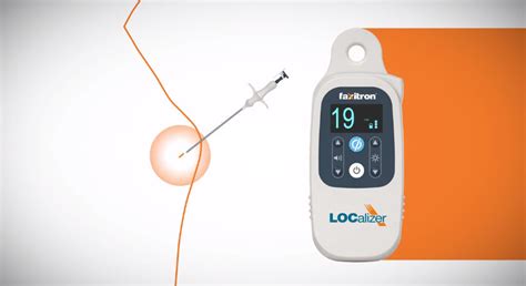 Localizer Tracking Marker Helps Doctors Zero In On Breast Lesions