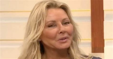 Carol Vorderman Sparks Major Surgery Concerns What Has She Done Daily Star