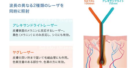 スプレンダーx ： 医療レーザー脱毛：美容外科 高須クリニック