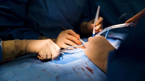 Electrosurgical Unit Cara Kerja Dalam Prosedur Bedah GRIN Astra