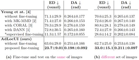 Adaptive 3d Localization Of 2d Freehand Ultrasound Brain Images