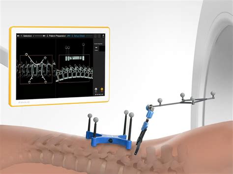Регистрация изображений Евромедмаркет официальный дистрибьютор Brainlab в России с 2012 года