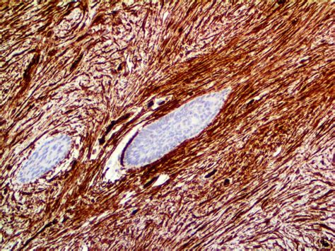 Podoplanin Antibody D2 40 Bio Sb